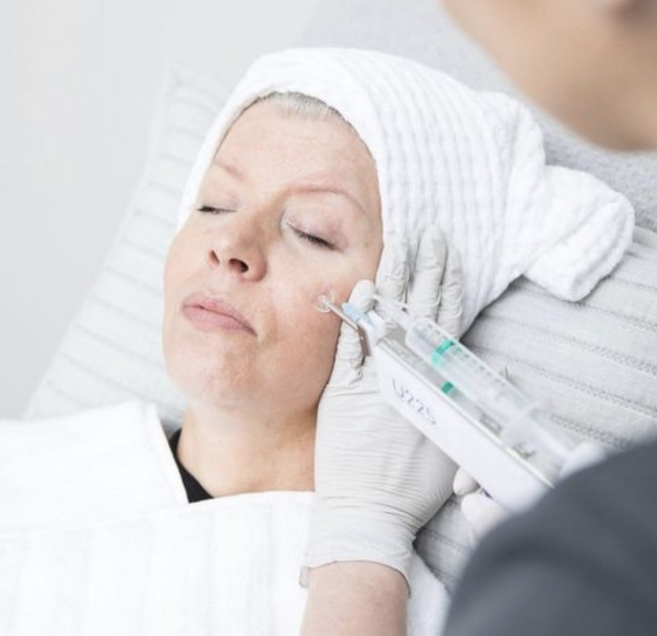 Deep Mesotherapy and Microneedling | Specialist Skin Clinic | Nuriss